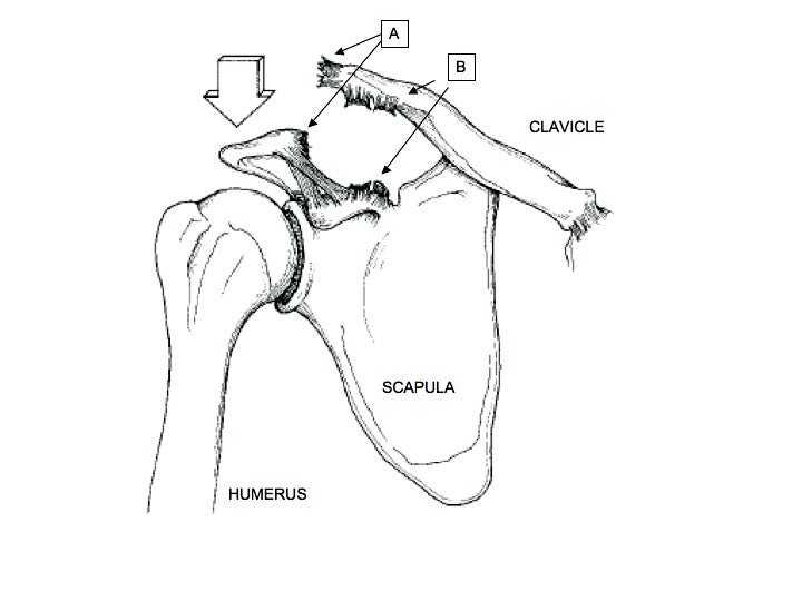 Shoulder separations explained - Velo