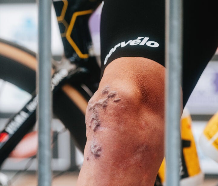 What's wrong with Van Aert? Or are we asking the wrong question?